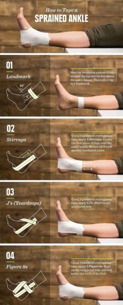 How to Tape a Sprained Ankle – Ballerina Magazine